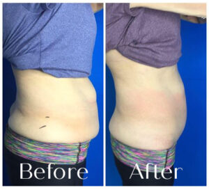 Cryoskin | Reactivation Massage